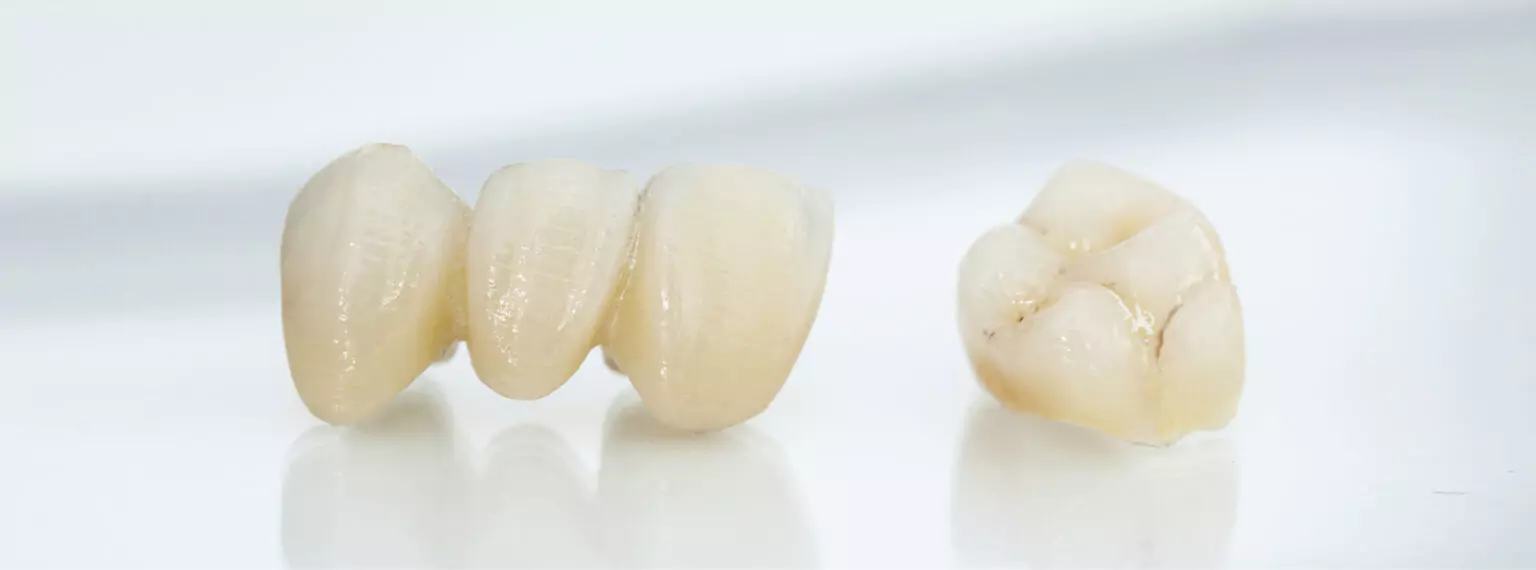 Dental Crowns Leeds | Leeds Dental Implant & Cosmetic Clinic | Custom ...